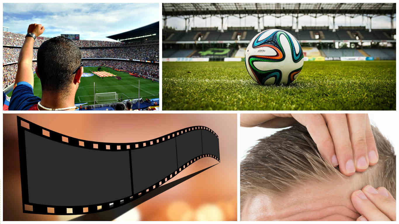 Injerto de pelo de Simeone - BonomédicoBlog